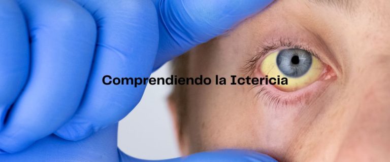 Comprendiendo la Ictericia: Causas, Síntomas y Tratamiento